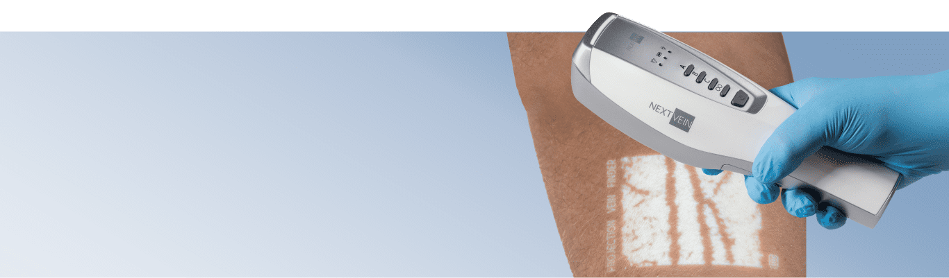 Affordable High-Performance Vein Finder | NextVein Australia