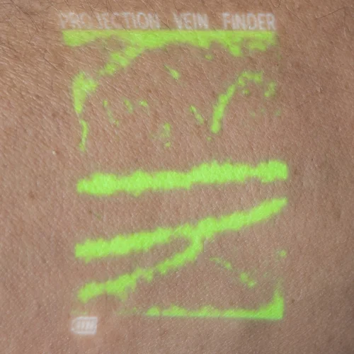 Affordable High-Performance Vein Finder | NextVein Australia