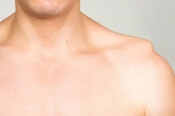 Fræðsla — Axlarklínikin