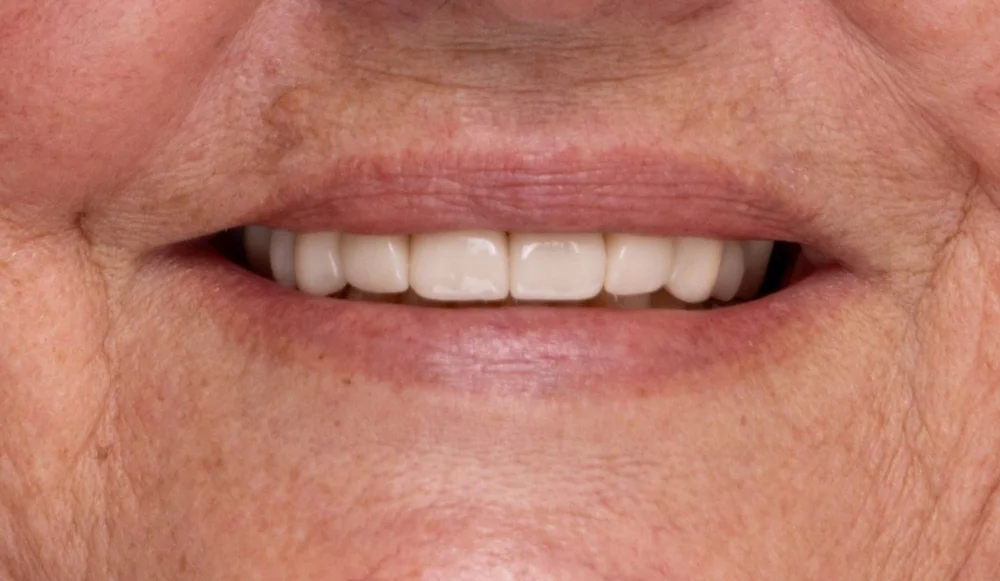 Smile Gallery — Chukhman Dental Studio