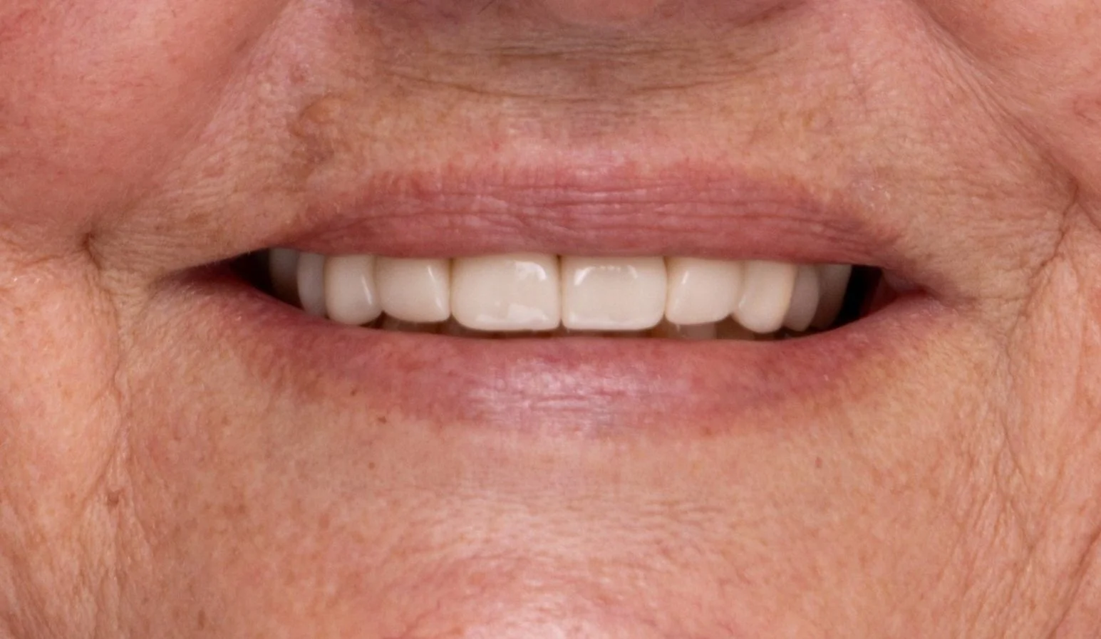 Smile Gallery — Chukhman Dental Studio