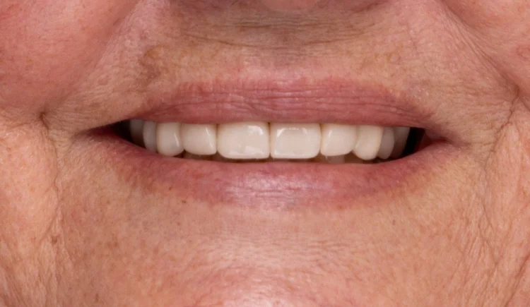 Smile Gallery — Chukhman Dental Studio