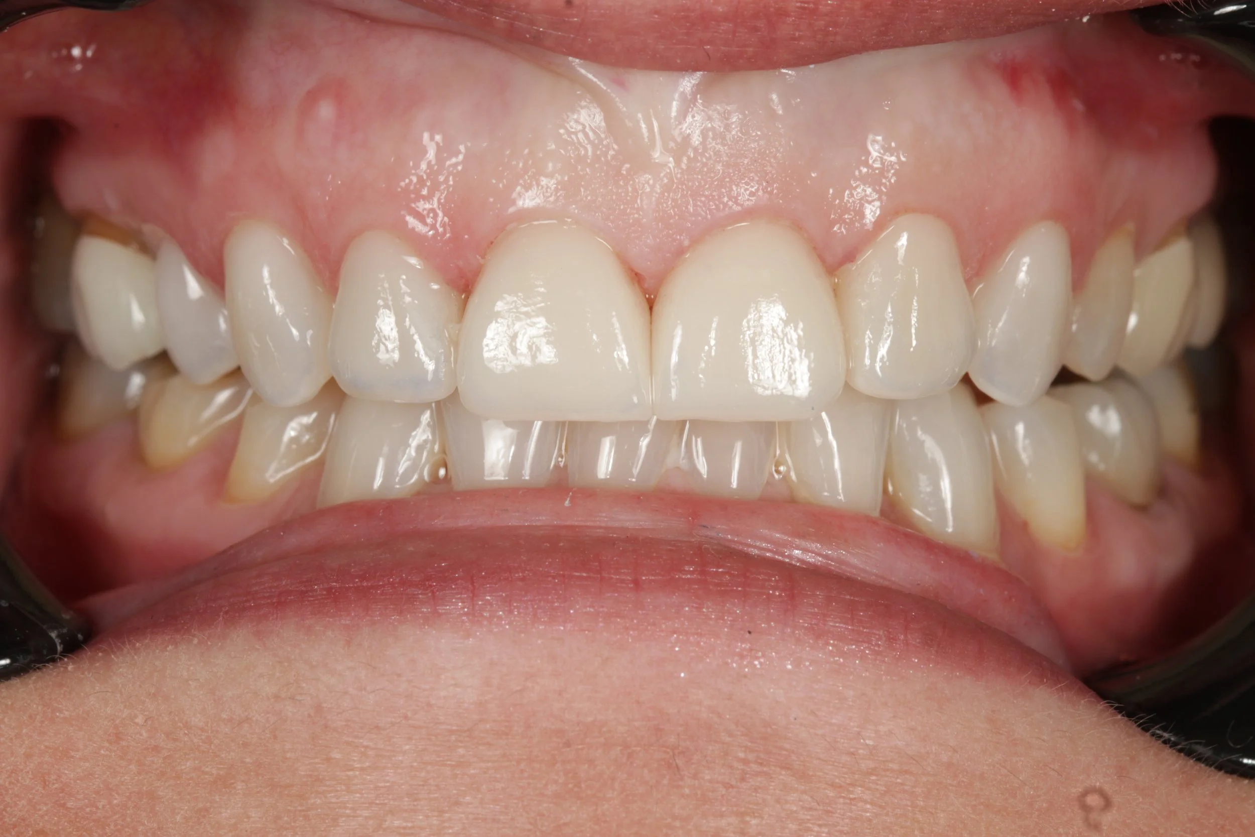 Cosmetic Dentistry — Chukhman Dental Studio