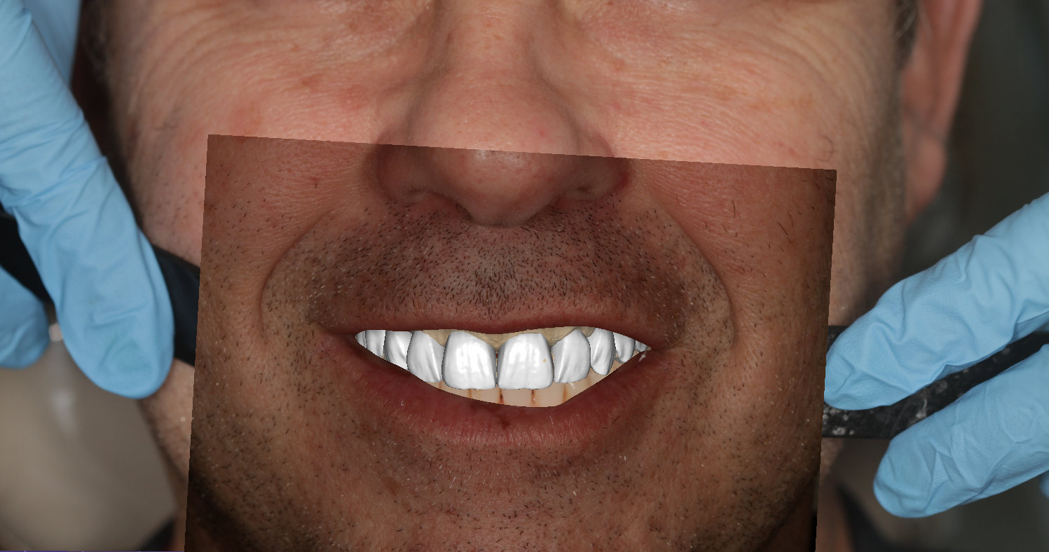 3D Smile Design — Chukhman Dental Studio