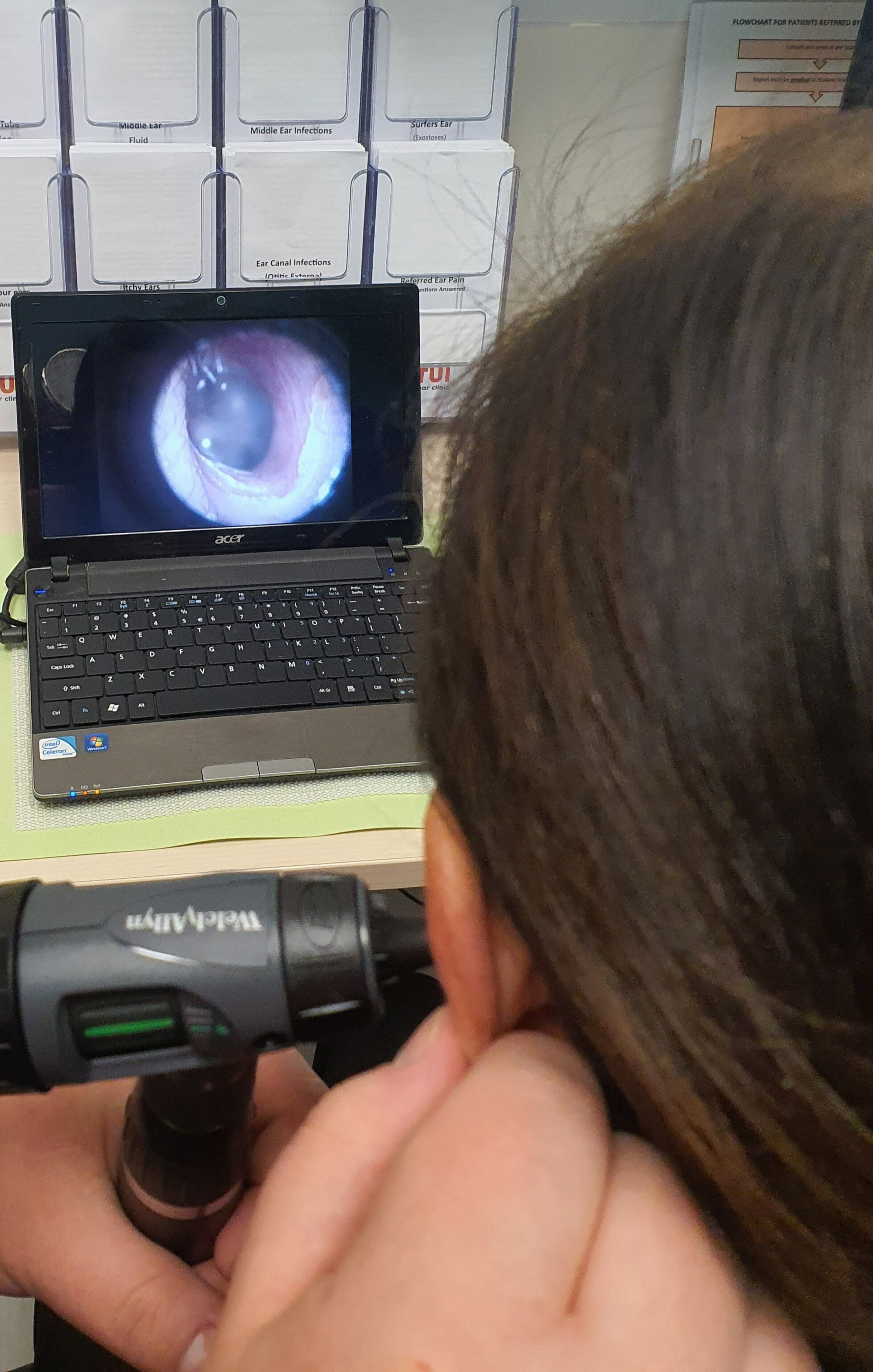 Free Ear Canal Checks — TOLBECS EAR CLINIC