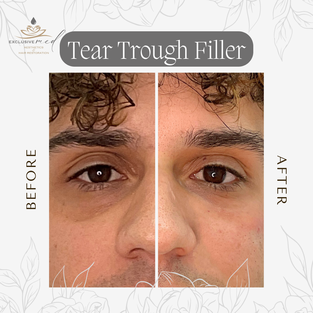 Photo and Informational Flyer Gallery | Exclusive Med Aesthetics ...