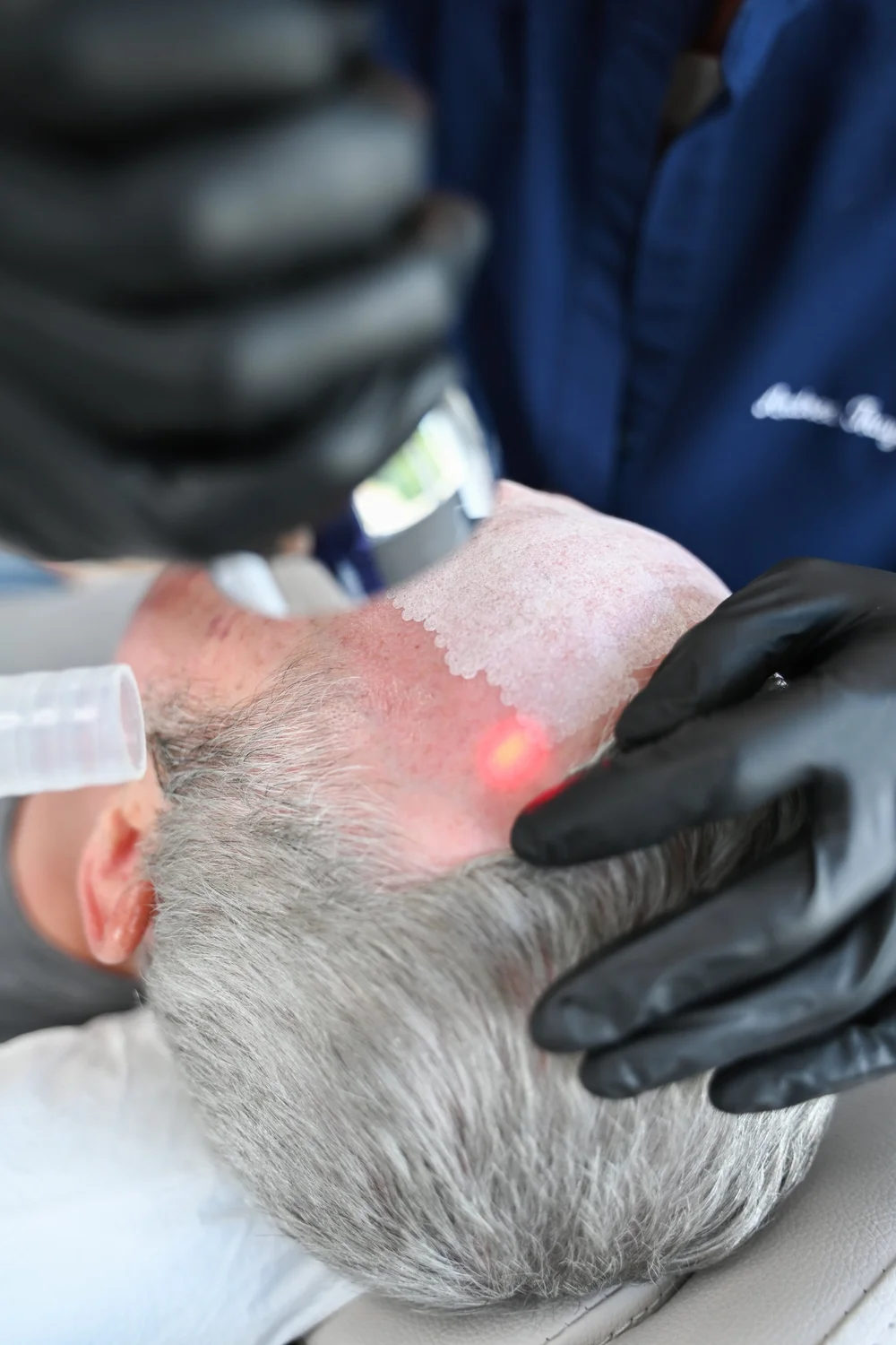 Sciton Contour TRL - NanoLaserPeel, MicroLaserPeel - Aesthetic Laser ...