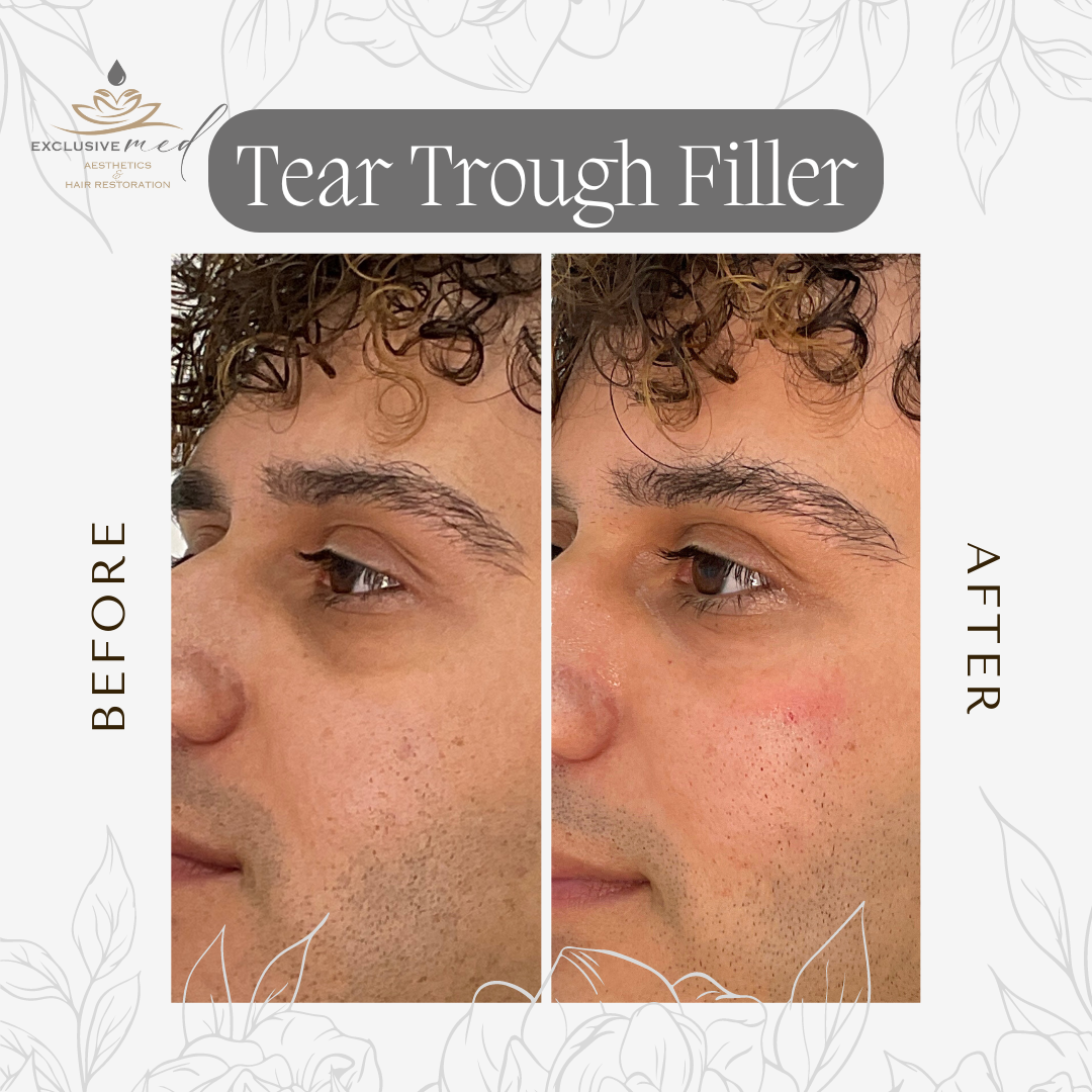 Photo and Informational Flyer Gallery | Exclusive Med Aesthetics ...