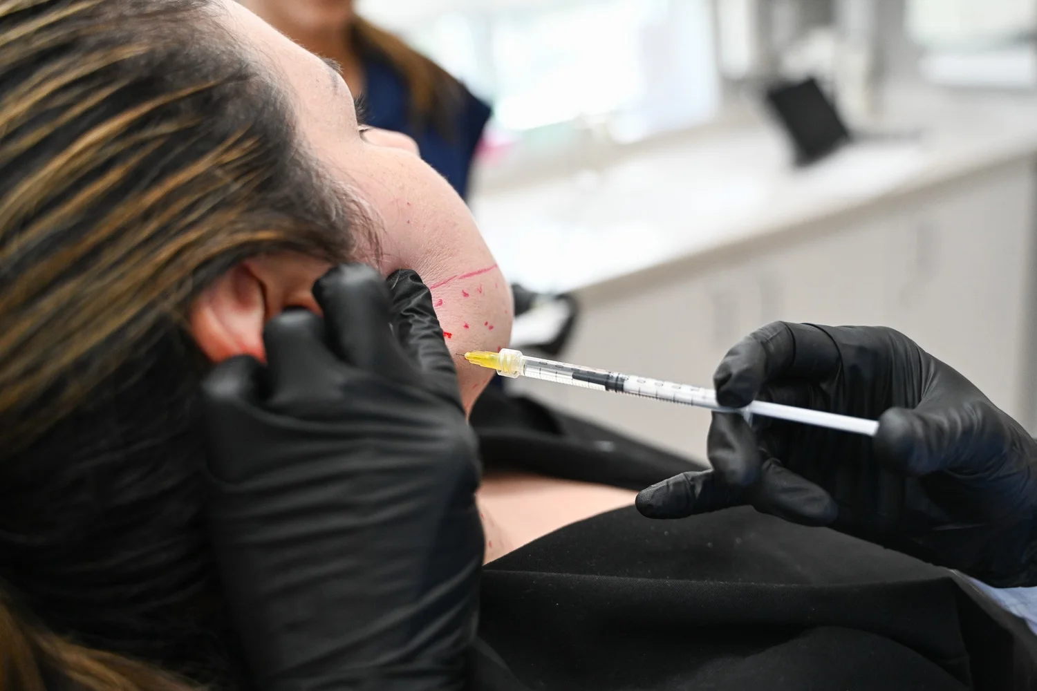 Liquid Lipo, PCDC - Minimally Invasive Fat-Dissolving Procedure ...