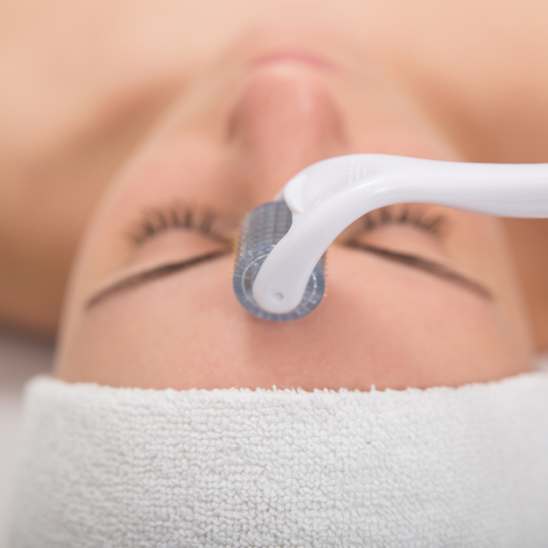 Microneedling: Painful or Helpful? — Innacos Labs