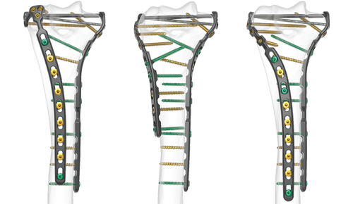 FIXATION: Skeletal Dynamics — Medella Northwest