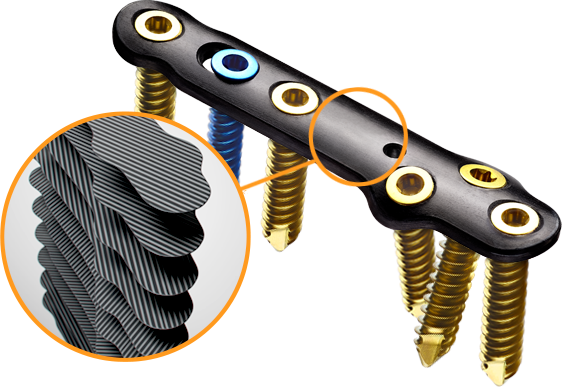 FIXATION: ConMed | In2Bones | Discover Innovative Fixation Solutions ...