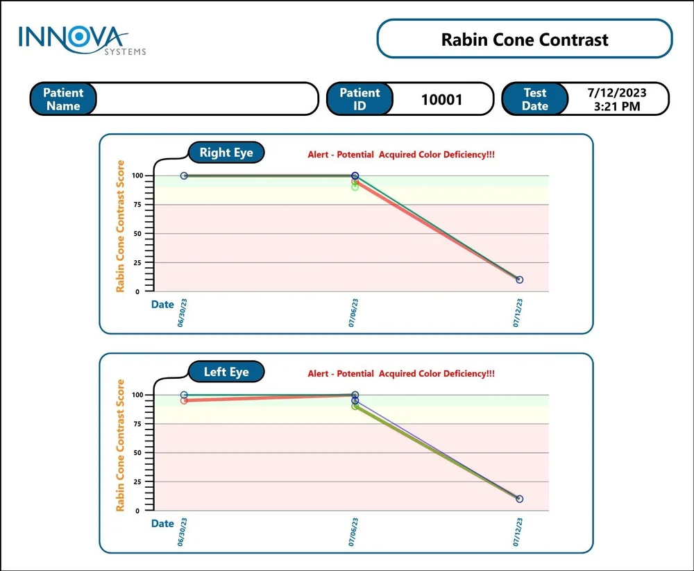 Rabin Cone Contrast Tech — Innova Systems
