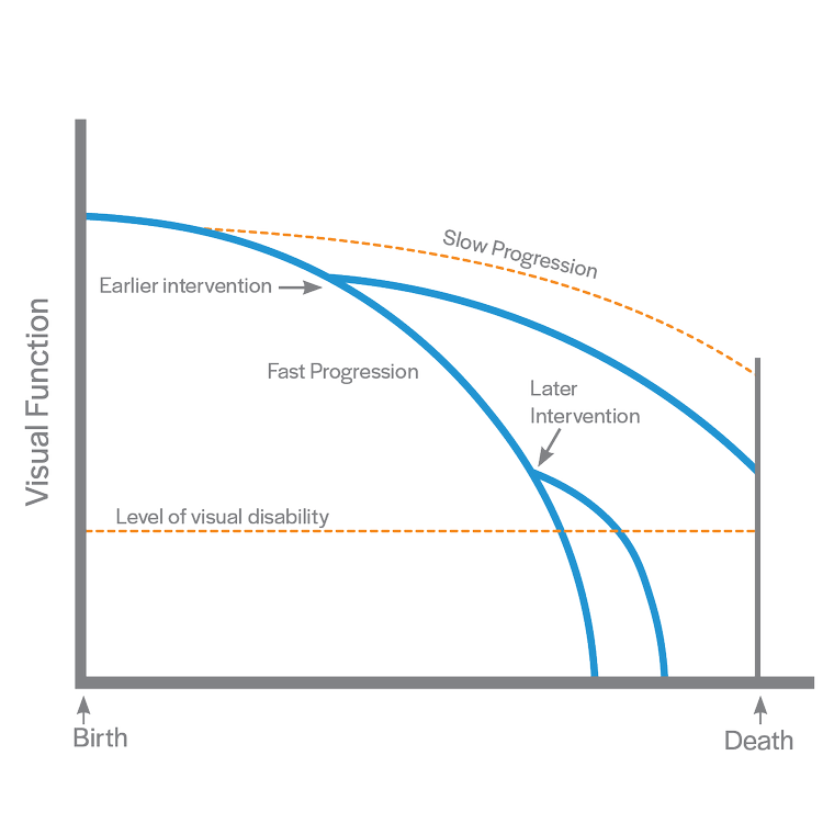 Why Color Vision — Innova Systems