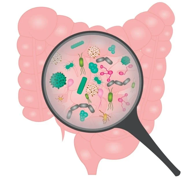 Post-Infectious IBS: How a Gut Infection Can Trigger Long-Term IBS ...