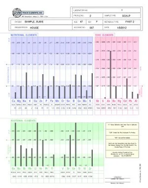 HTMA 101: What is a Hair Tissue Mineral Analysis — Gut Talk