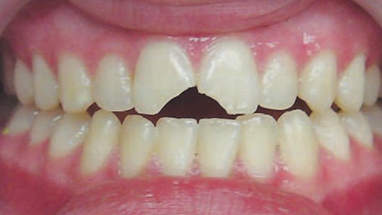 Emergency Dentist Dublin | 24/7 Emergency Dental Care — Slievemore Dental
