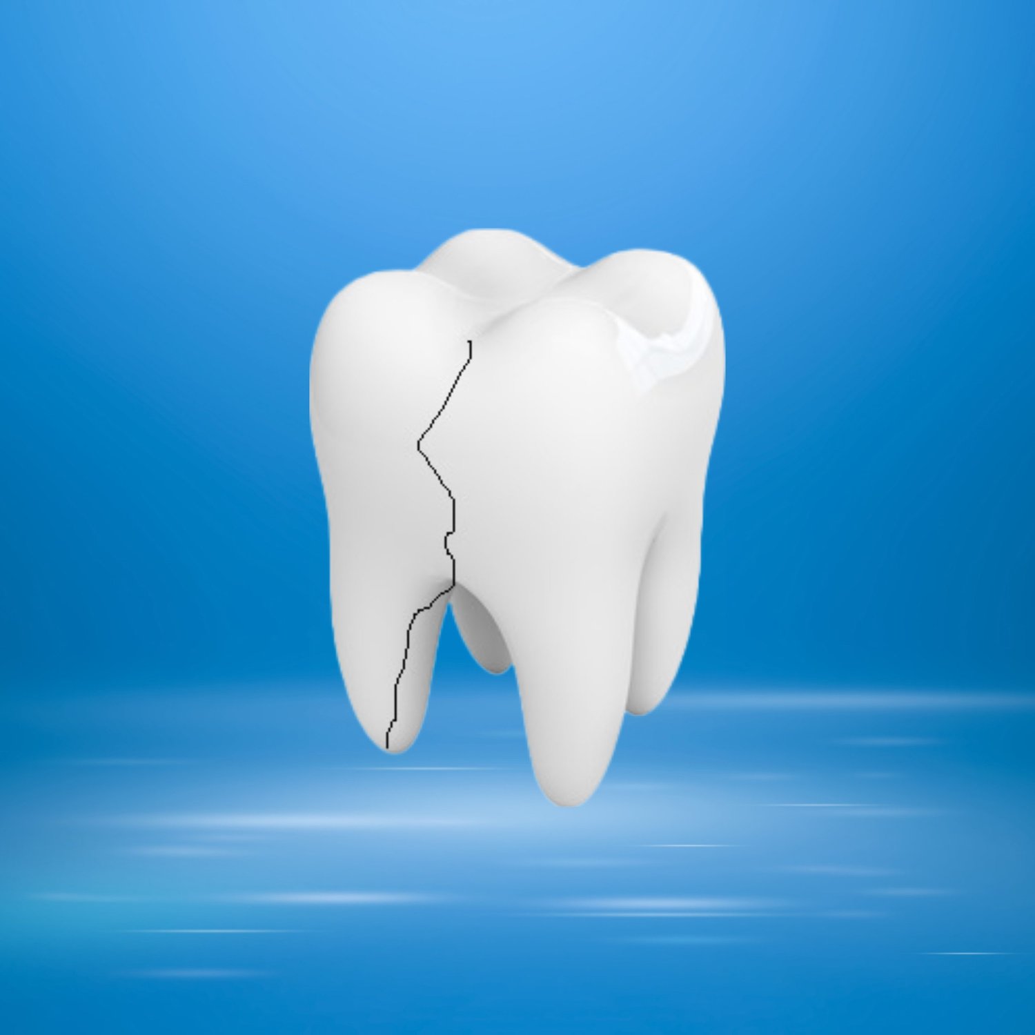 Emergency Dentist Dublin | 24/7 Emergency Dental Care — Slievemore Dental