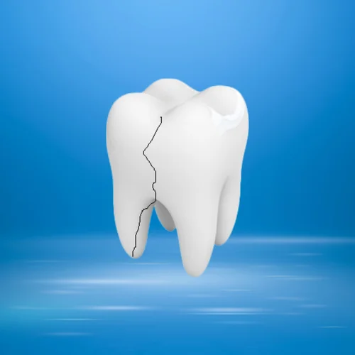 Emergency Dentist Dublin | 24/7 Emergency Dental Care — Slievemore Dental