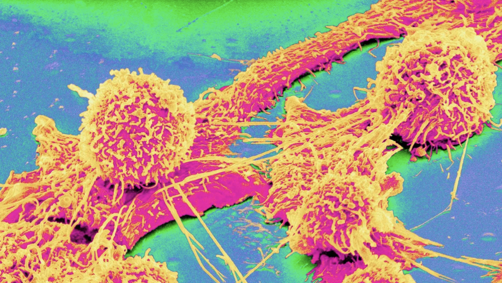 Learn to Beat Cancer | Explore Cancer Solutions