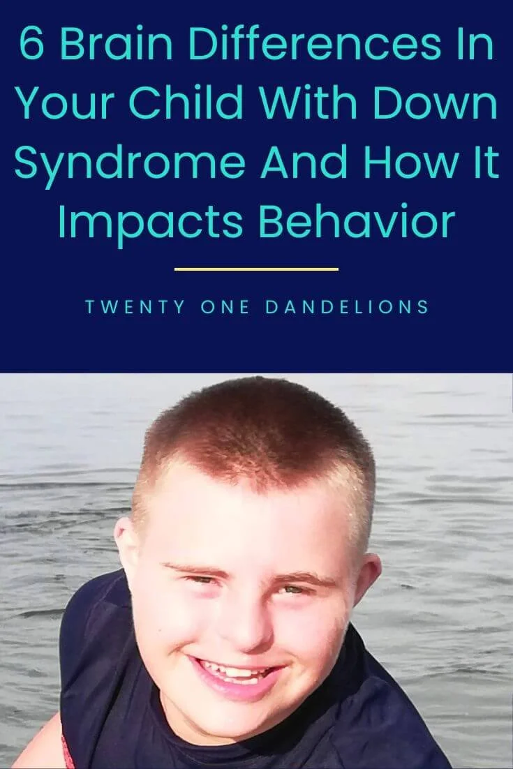 6 Brain Differences In Your Child With Down Syndrome And How It Impacts ...