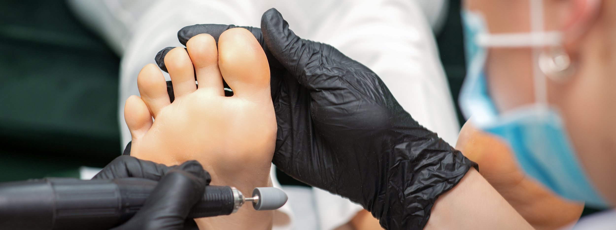 Podiatry and Chiropody Services in Chester | Foot and Ankle Specialists for Injury ...