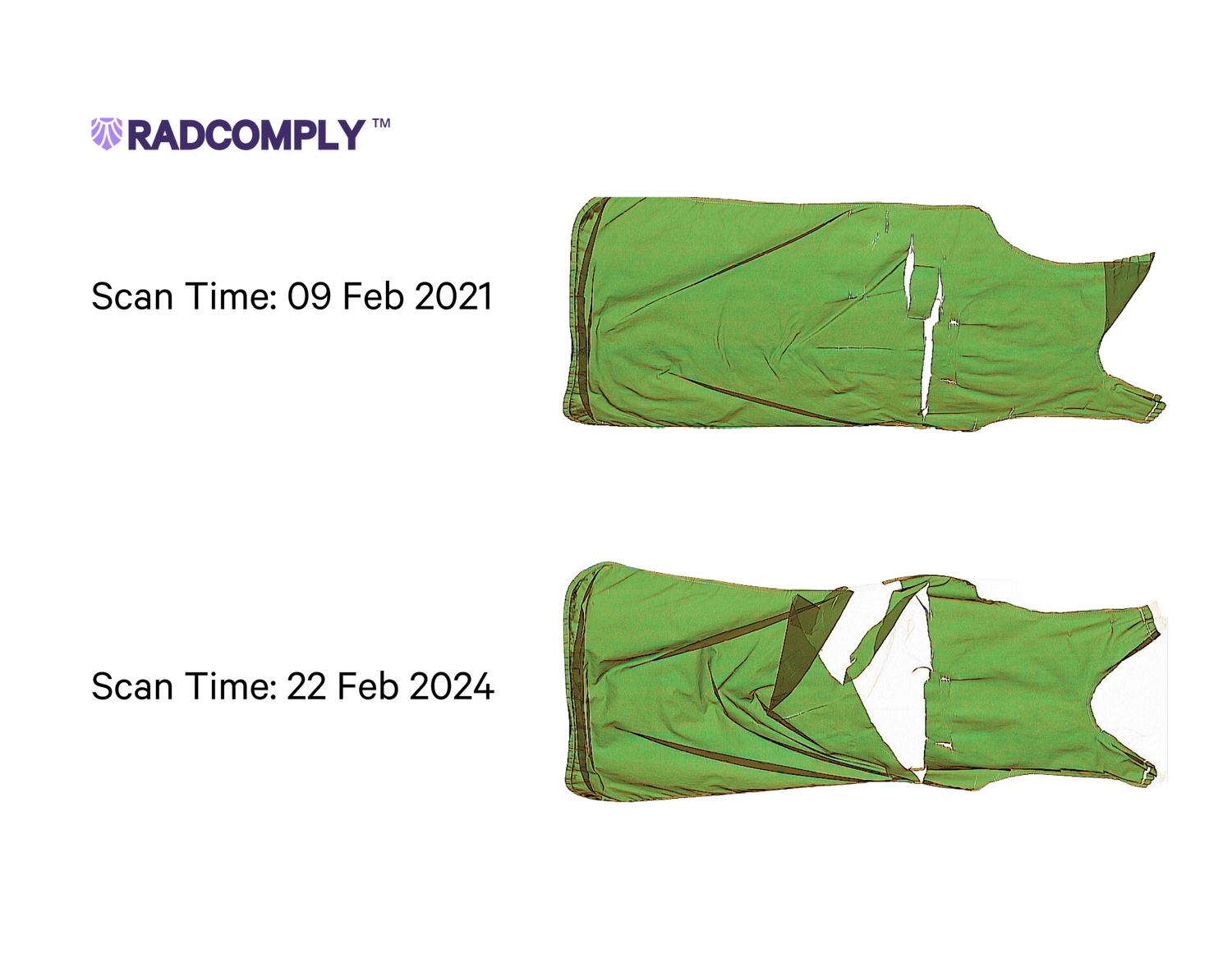 Lifespans of Lead Aprons (and Signs It’s Time for Replacement) - RCS