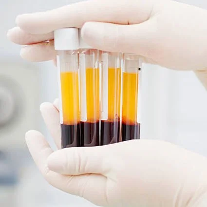 Plasma Rich Protein (PRP) Therapy – Natural Healing & Rejuvenation ...