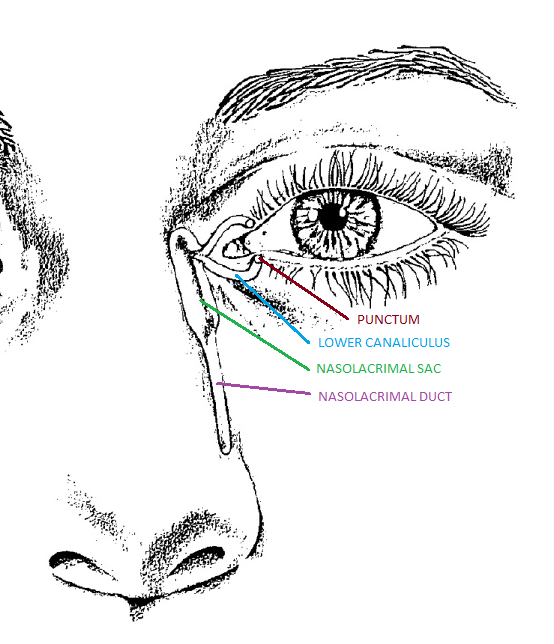 Tearing and Tear Drain Problems — Oculoplastic Consultants of Arizona