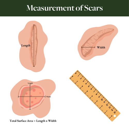 Scar VA Rating Criteria Explained — Greene-Marusak