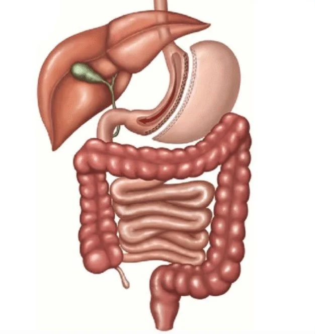 Weight Loss Surgery — Louisiana Center for Bariatrics at Baton Rouge ...