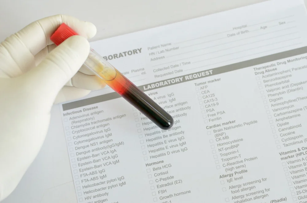 PMH Laboratory, Inc.| Irvine, CA