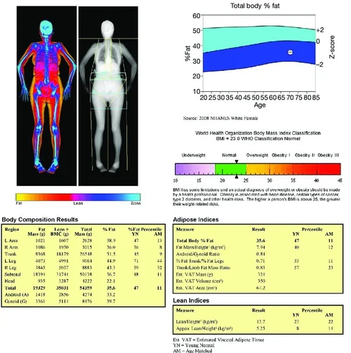 Interpreting Your DEXA — VITALITY