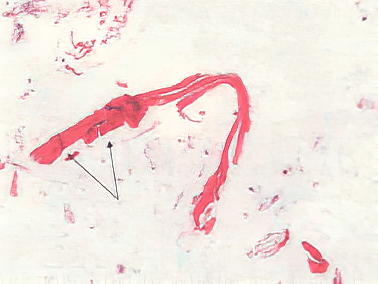 Eucharistic Miracles: God Under the Microscope — Saint Beluga