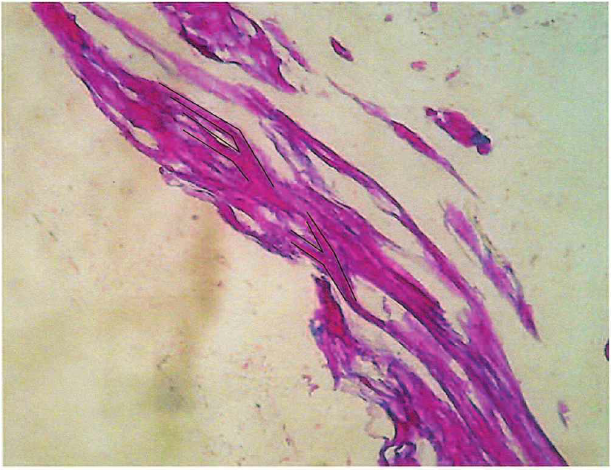 Eucharistic Miracles: God Under the Microscope — Saint Beluga