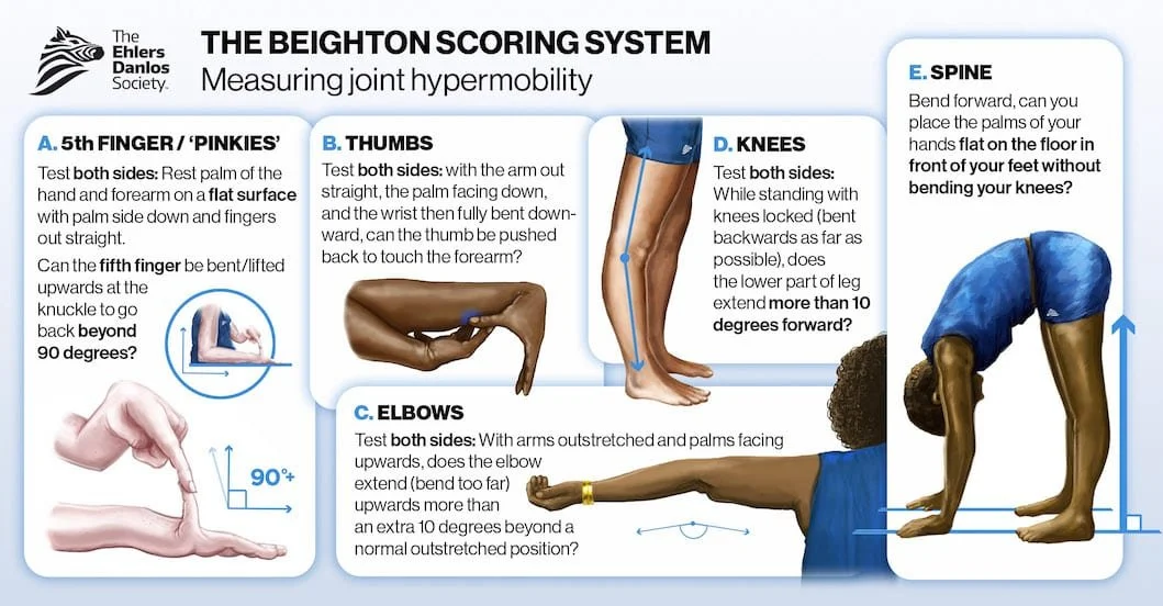 Understanding Joint Hypermobility & Hypermobile Ehlers-Danlos-Syndrome ...