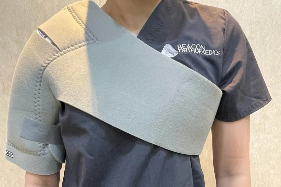 Beacon Orthopaedics - Shoulder Arthroscopy Recovery Guide | Beacon ...