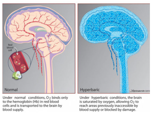 Mild Hyperbaric Oxygen Chamber Aiken SC — Aiken Wellness Spa & Boutique
