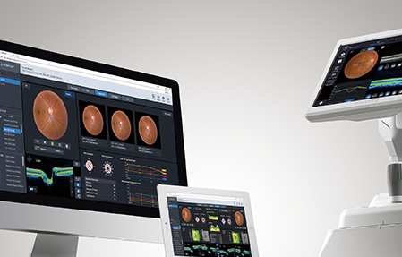 Huvitz HOCT-1/1F OCT — Mandarin Opto-Medic