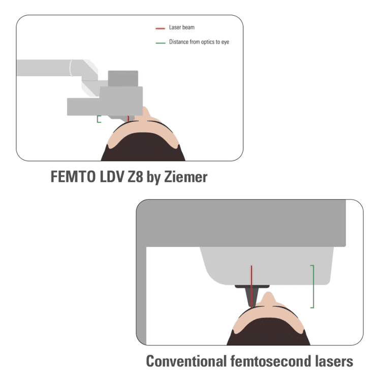 Ziemer FEMTO LDV Z8 Femtosecond Laser — Mandarin Opto-Medic