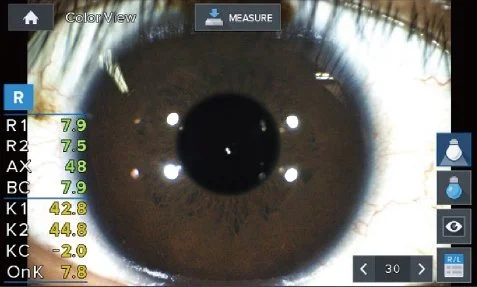 Huvitz HRK-1 Auto Ref/Keratometer — Mandarin Opto-Medic