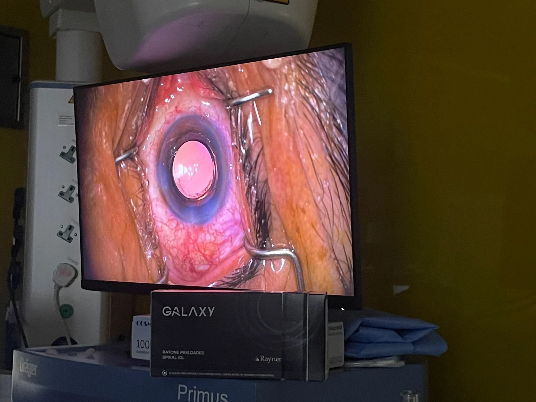 News & Events | Stay Updated — Explore Eye Care Innovations — Mandarin ...