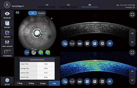 Huvitz HOCT-1/1F OCT — Mandarin Opto-Medic