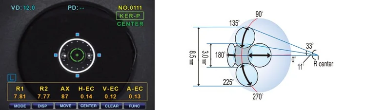 Huvitz HRK-7000/ 7000A Auto Ref/Keratometer — Mandarin Opto-Medic