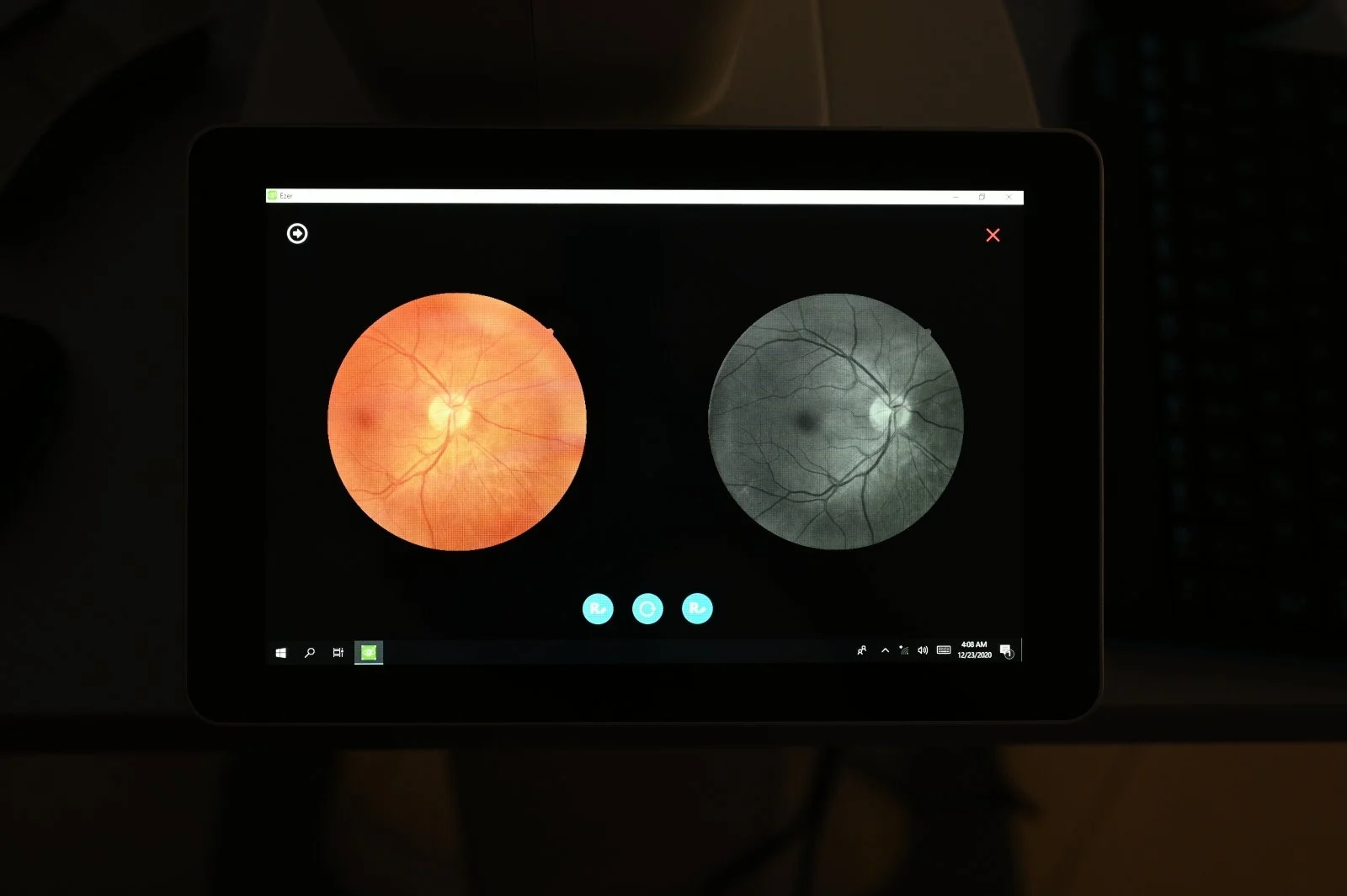 Crystalvue NFC-700 Retinal Camera — Mandarin Opto-Medic