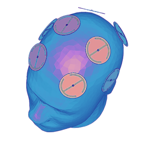 About NeuroEM — NeuroEM