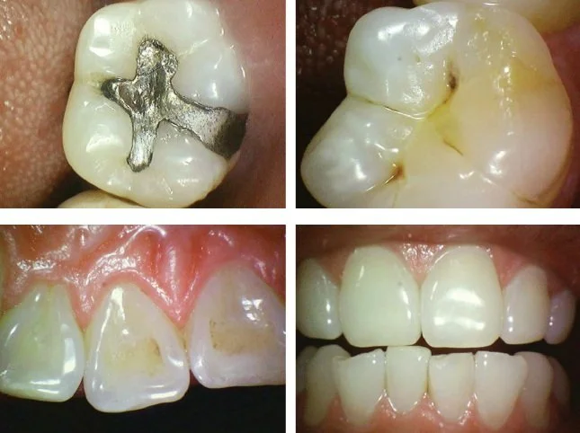 LED IC100 Intraoral Cameras | Tuxedo Imaging | Tuxedo Imaging