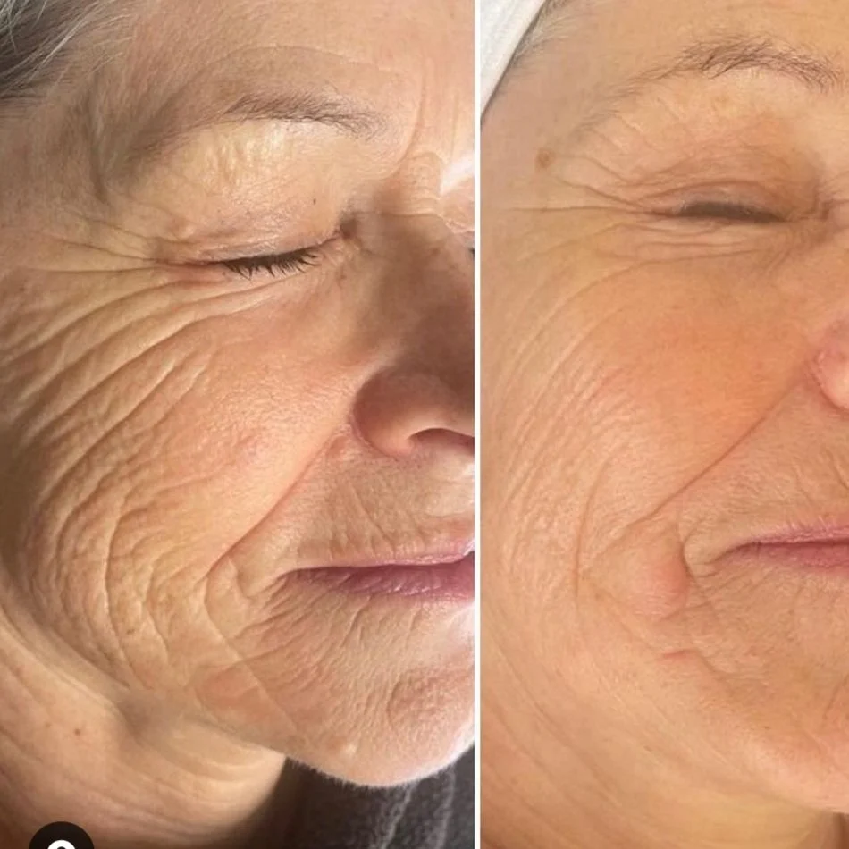 Treatments & equipment — Prices