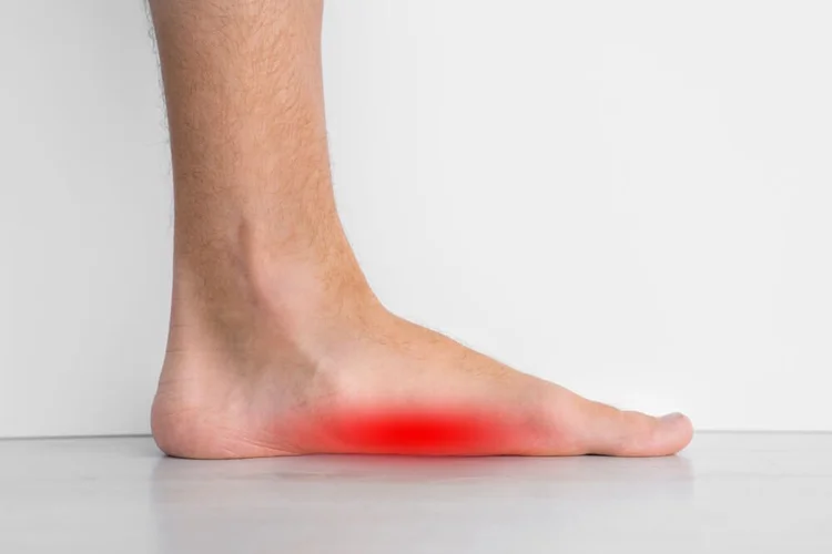 Are You Struggling with Foot Arch Pain? — Dr. Scott Russell Podiatry ...