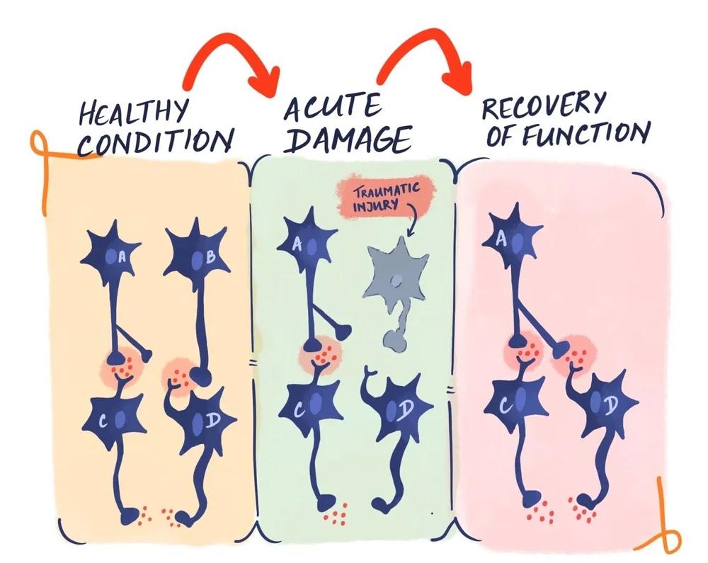 The Top 10 Balance Exercises Every Brain Injury Patient Should Try ...